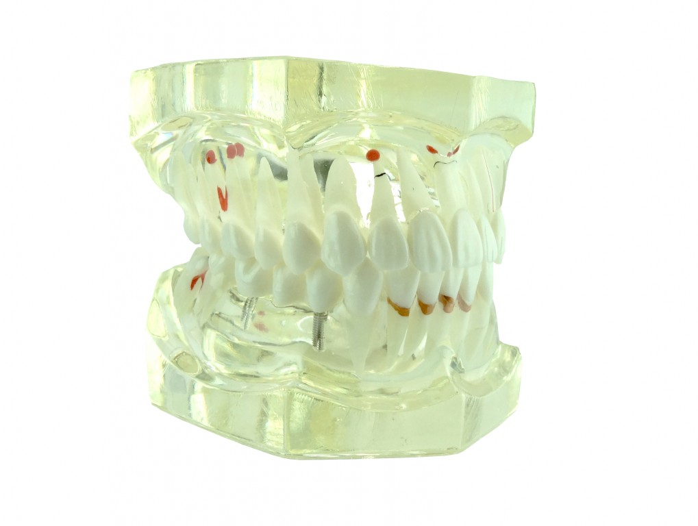 867 ARTICULATED NORMAL TEETH | COLUMBUS # GRANDE | US Dental Depot