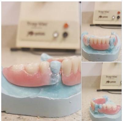 ACRYFLEX PRE-MADE CLASPS | AcryFlex # pc00 | US Dental Depot