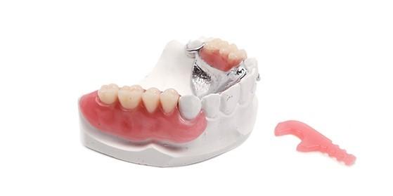 ACRYFLEX PRE-MADE CLASPS | AcryFlex # pc00 | US Dental Depot